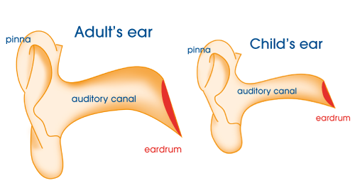 A-cerumen - A-Cerumen and children